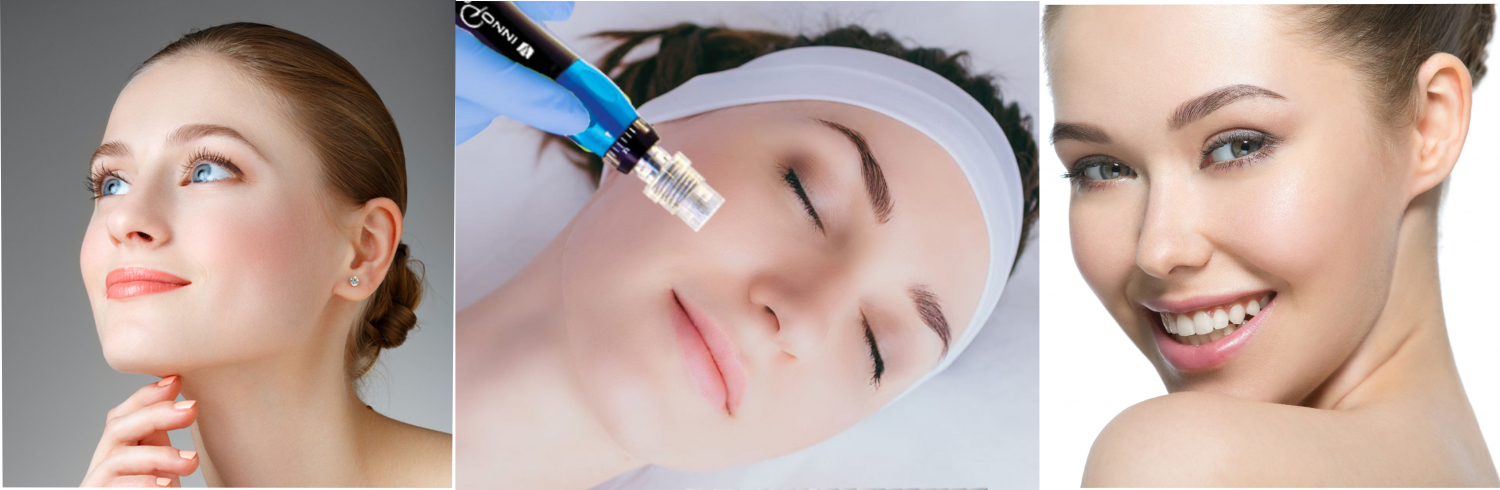 Micro-Needling - Nell Skin Laser & Cosmetic Clinic | Toronto, North York